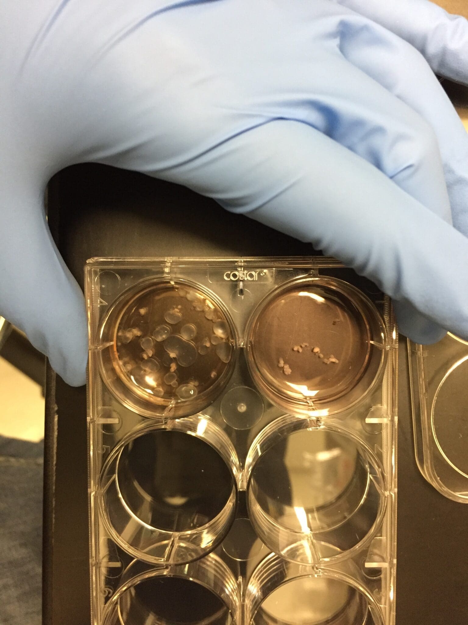 Mini-kidney organoids reveal renal disease secrets - Institute for Stem ...