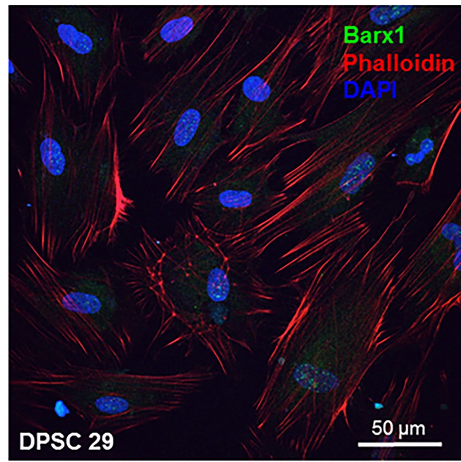 Are Stem Cells Key to Regenerative Therapies for Dentists? | ISCRM