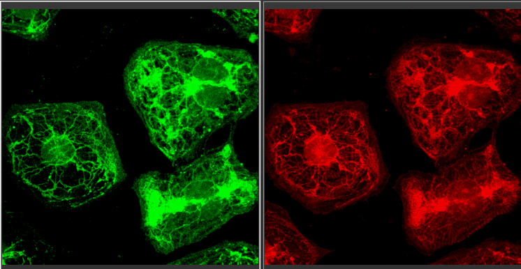 Researchers Link a Genetic Mutation to One Form of SIDS | ISCRM