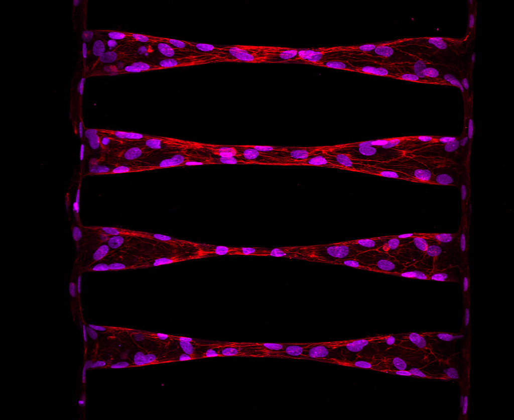 Breaking the Capillary Barrier | ISCRM at the UW