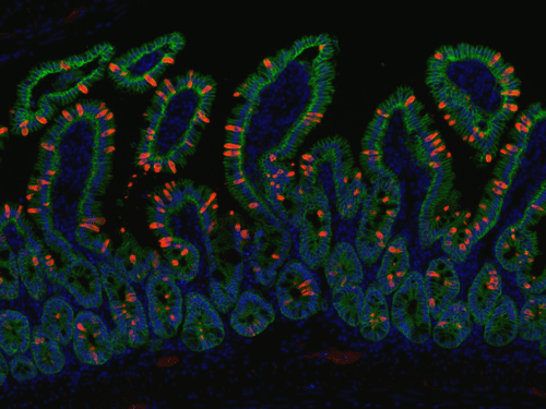 Studying the Rise and Role of Tuft Cells in the Intestine / ISCRM