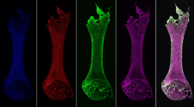 UW Team Models the Periodontal Ligament in 3D / ISCRM